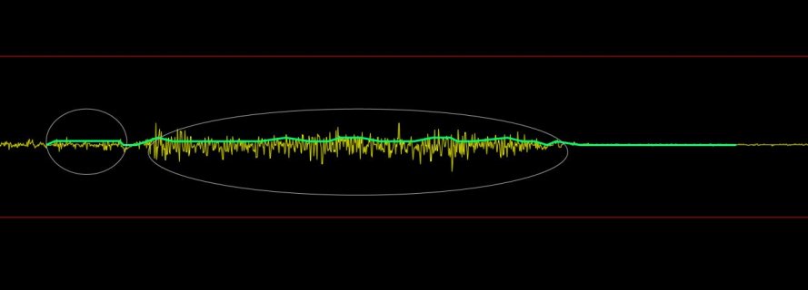 Signal smoothing or simplification | Teensy Forum
